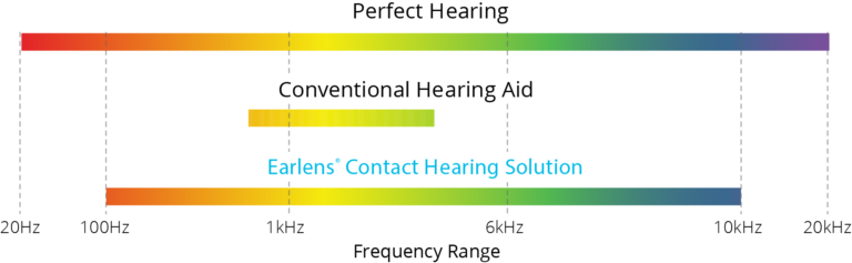 Earlens Hearing Aid: Available at Our New York City Office